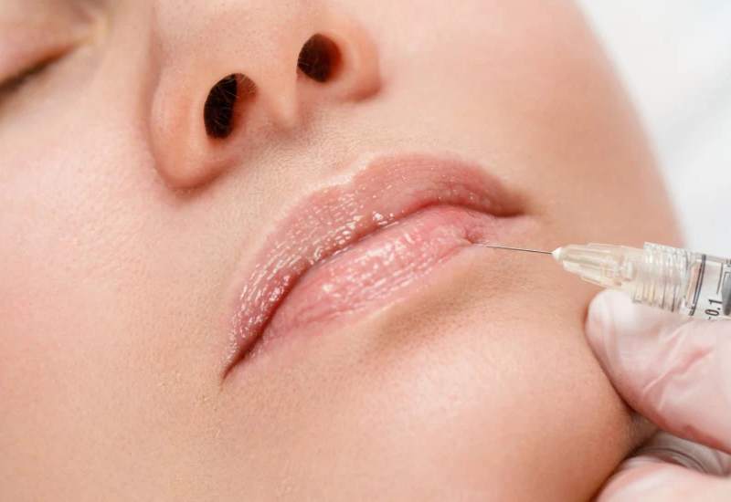 Do lip injections hurt? 7 Tips to prepare for a painless experience – diaminyaesthetics