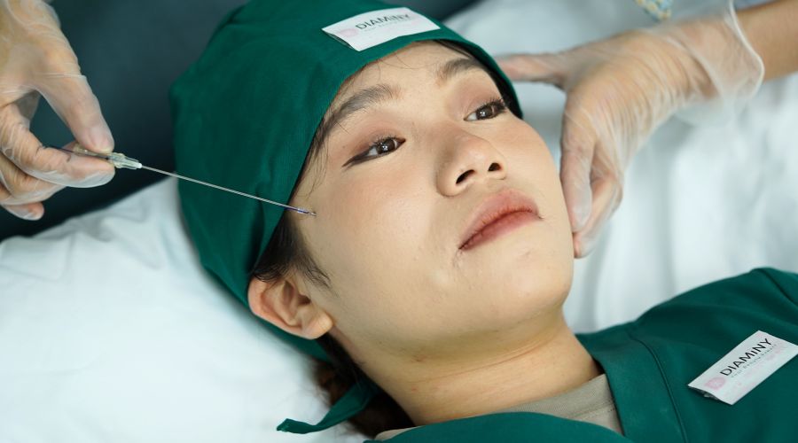 Cog Thread Lift VS Mono Thread Lift: Which is Right for You ...