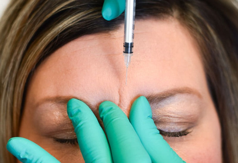 ¿Dónde se puede aplicar el bótox en el rostro? Zonas clave que debes ...