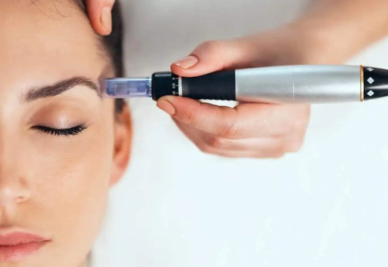 How To Microneedle the Face: Choosing The Right Device – diaminyaesthetics
