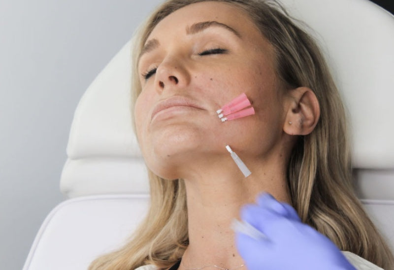 A comprehensive analysis of Wrinkle Threading – diaminyaesthetics