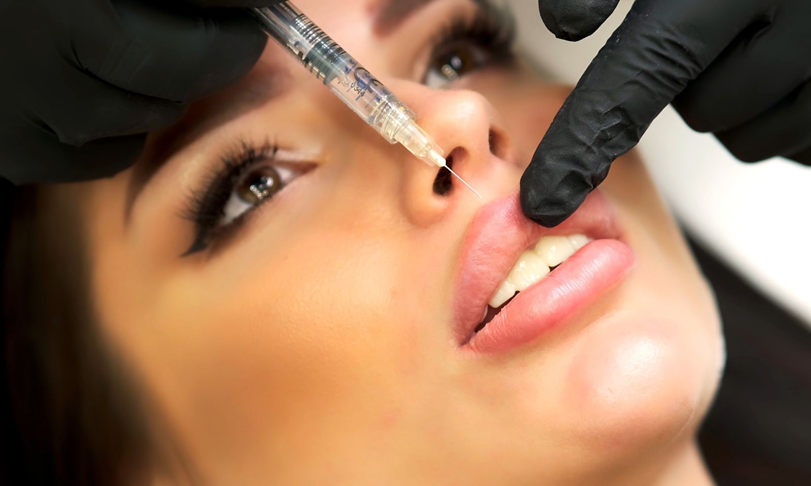 Where Not To Inject Lip Fillers: The Risks Revealed – diaminyaesthetics