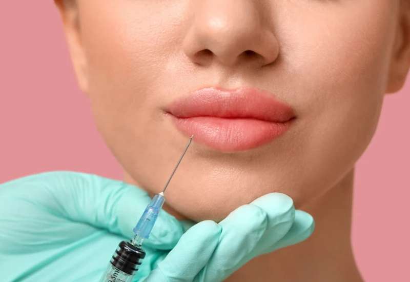 Différents types de lèvres et leur apparence – diaminyaesthetics