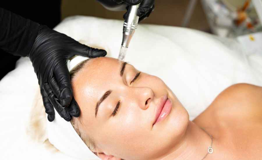 What Are the Main Healing Stages of Microneedling – diaminyaesthetics