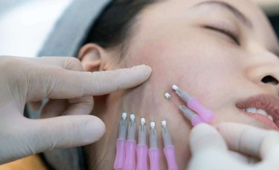 8 Possible Complications of Thread Lift and How to Manage Them ...