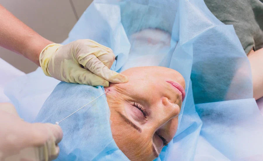 Top 10 Advantages and Disadvantages of Thread lifts – DiaminyAesthetics