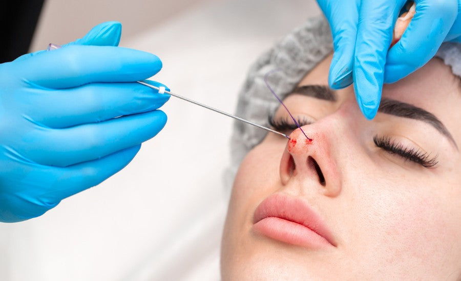 Food to Avoid After Nose Thread Lift: Essential Dietary Tips ...