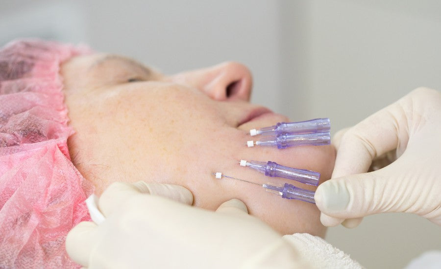 How to Reduce Swelling After Thread Lift – diaminyaesthetics