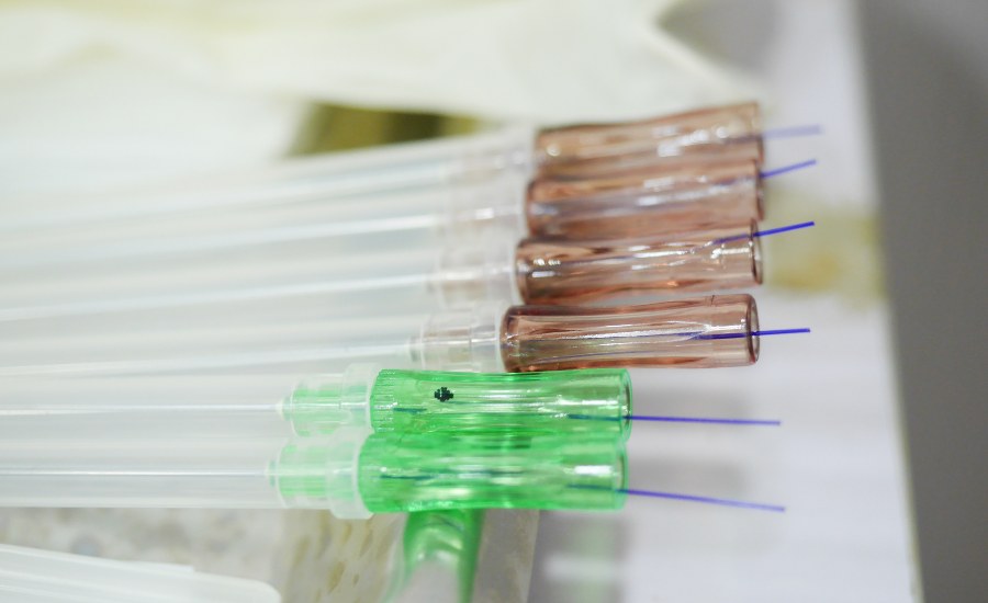 How Many Threads Are Used In A Thread Lift Procedure? – diaminyaesthetics